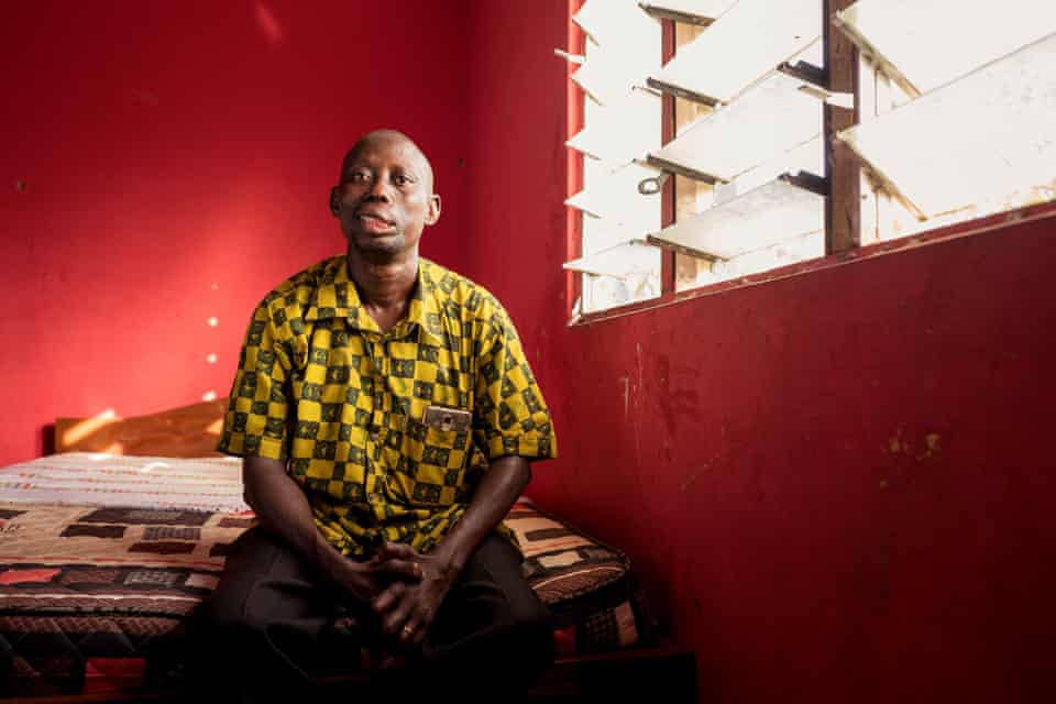 Ghana intensifies measures to eliminate leprosy | Ghana News Agency