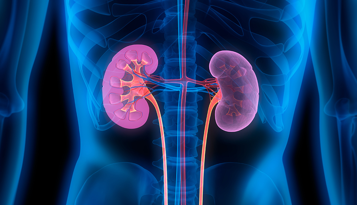 Four million Ghanaians living with silent kidney disease — Experts say ...