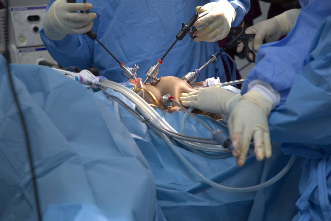 UGMC conducts its first Laparoscopic Bariatric surgery | Ghana News Agency